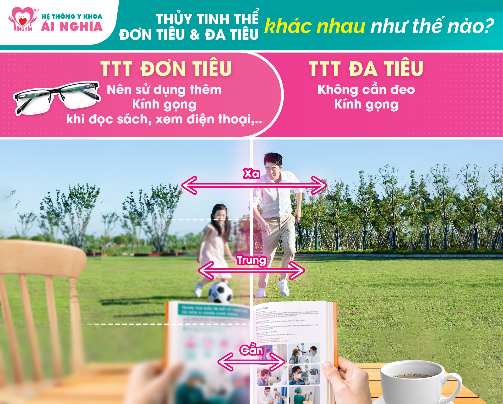 Thủy Tinh Thể đơn Tiêu Và đa Tiêu Khác Nhau Như Thế Nào Hệ Thống Y